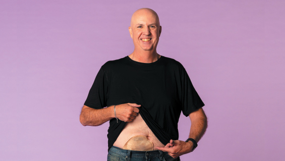 Increasing Awareness of Inflammatory Bowel Disease and Stomas | Dansac UK